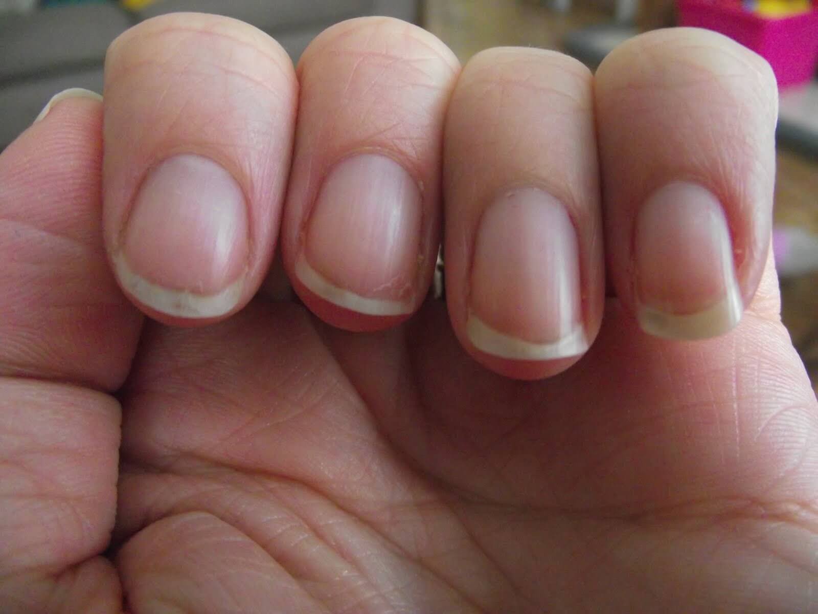 Signs that you need a mani or pedi